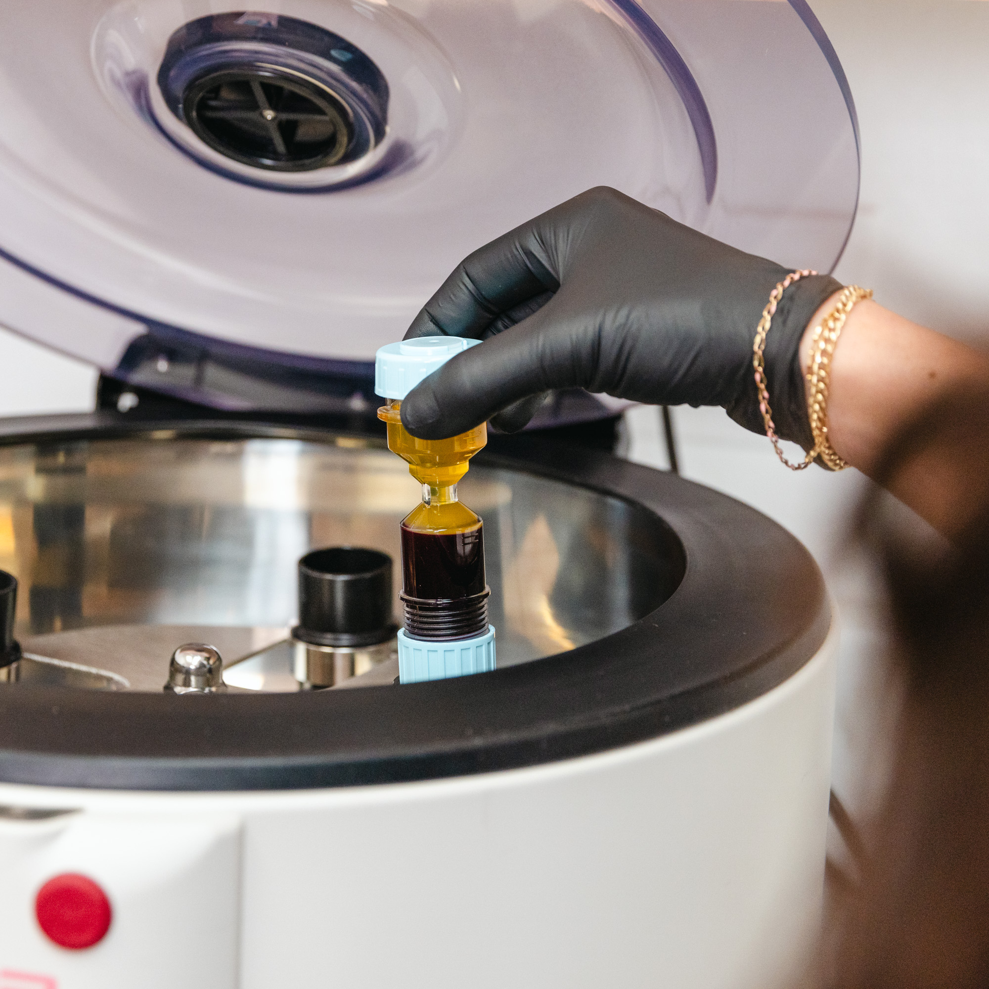 PRP Injections in Sioux City | Lace & Needle