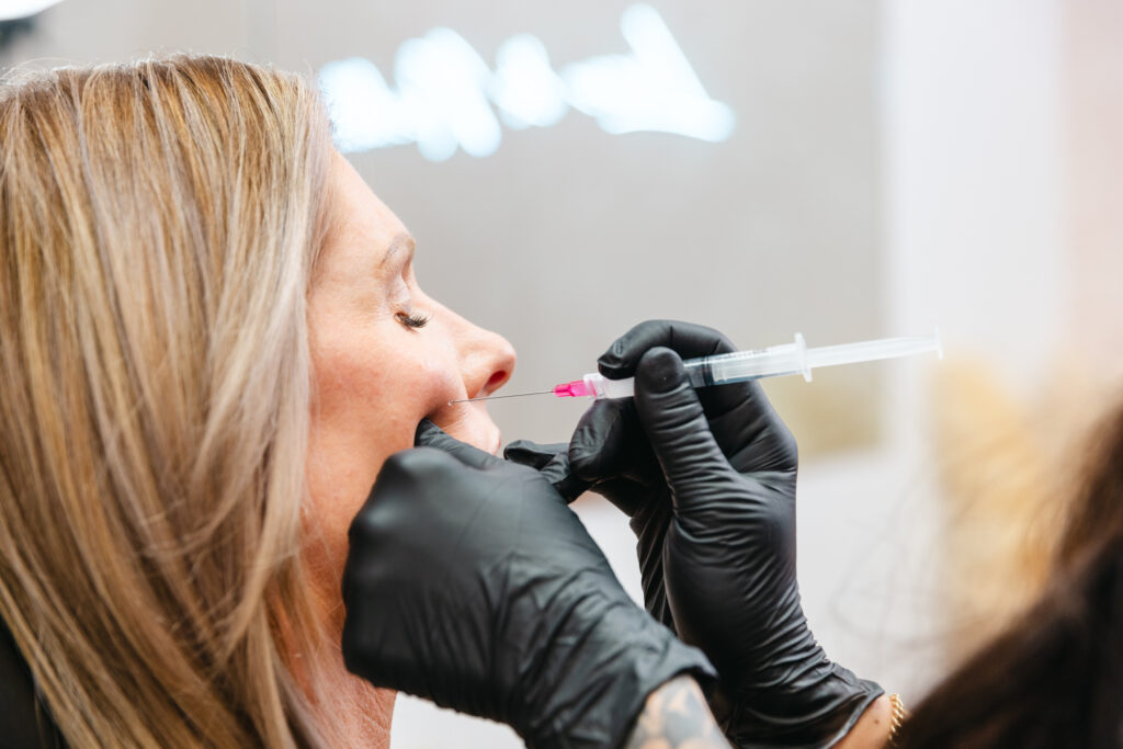 Sculptra in Sioux City | Lace & Needle